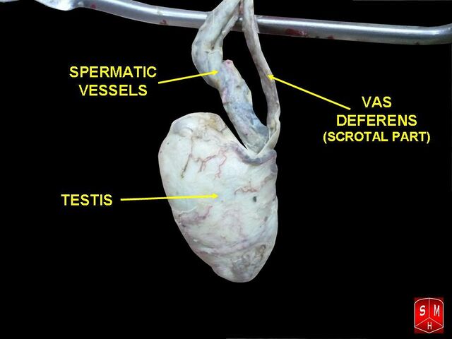 ملف:Testis, spermatic vessels and vas deferens 2.jpg - المعرفة